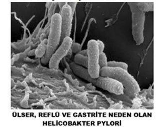 Mide ülseri, reflü ve gastridin tedavisi Mormordica'da saklı - Sağlık ...