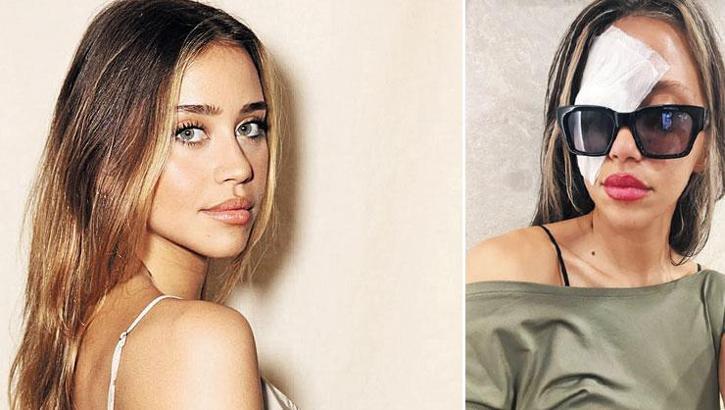 Zeynep Alkan ameliyat oldu! 'İnsan tedirgin oluyor' - Son Dakika ...