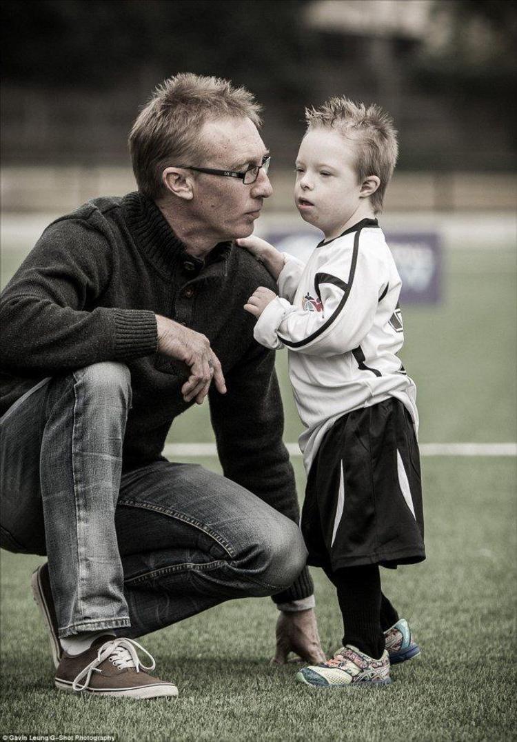 Down sendromlu Henry mucizesi - Yaşam Haberleri