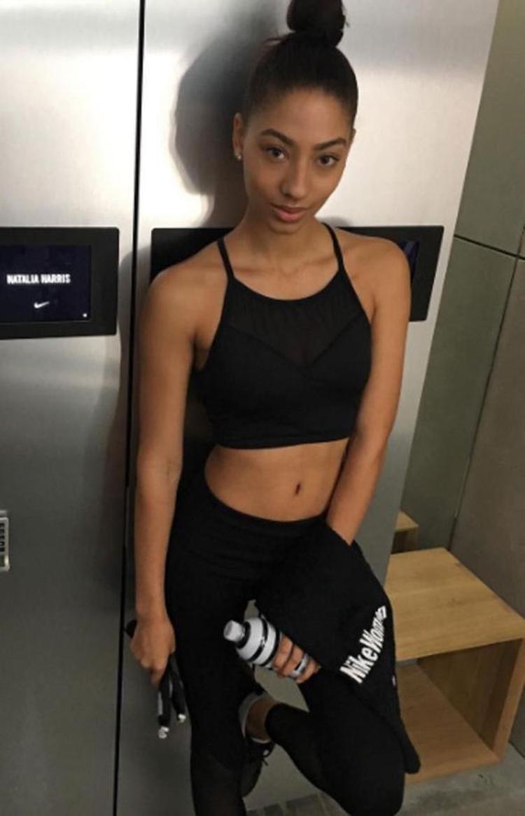 Genç model hayatının trajedisini mucizeye çevirdi! - Son Dakika Dünya ...