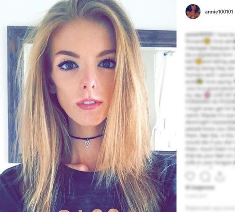 Anoreksiya hastalığına yakalanmıştı, şimdi ise bambaşka biri! - Dünya ...