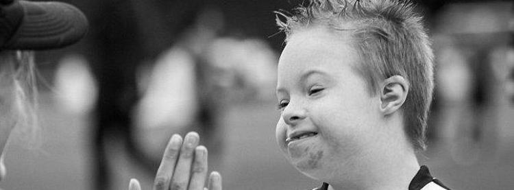 Down sendromlu Henry mucizesi - Yaşam Haberleri