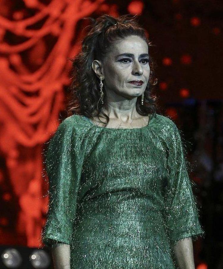 Yıldız Tilbe sahnede peruğunu çıkarttı - Son Dakika Magazin Haberleri