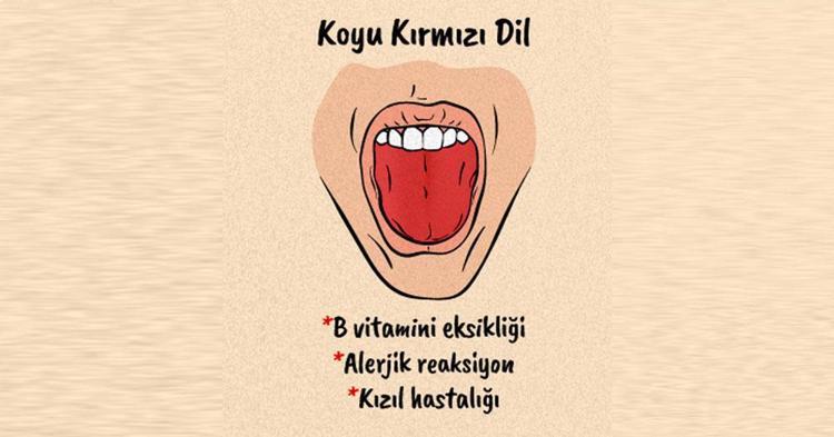 Kırmızı dil rengi bu hastalığın işareti! Doktorlar bu yüzden bakıyormuş ...