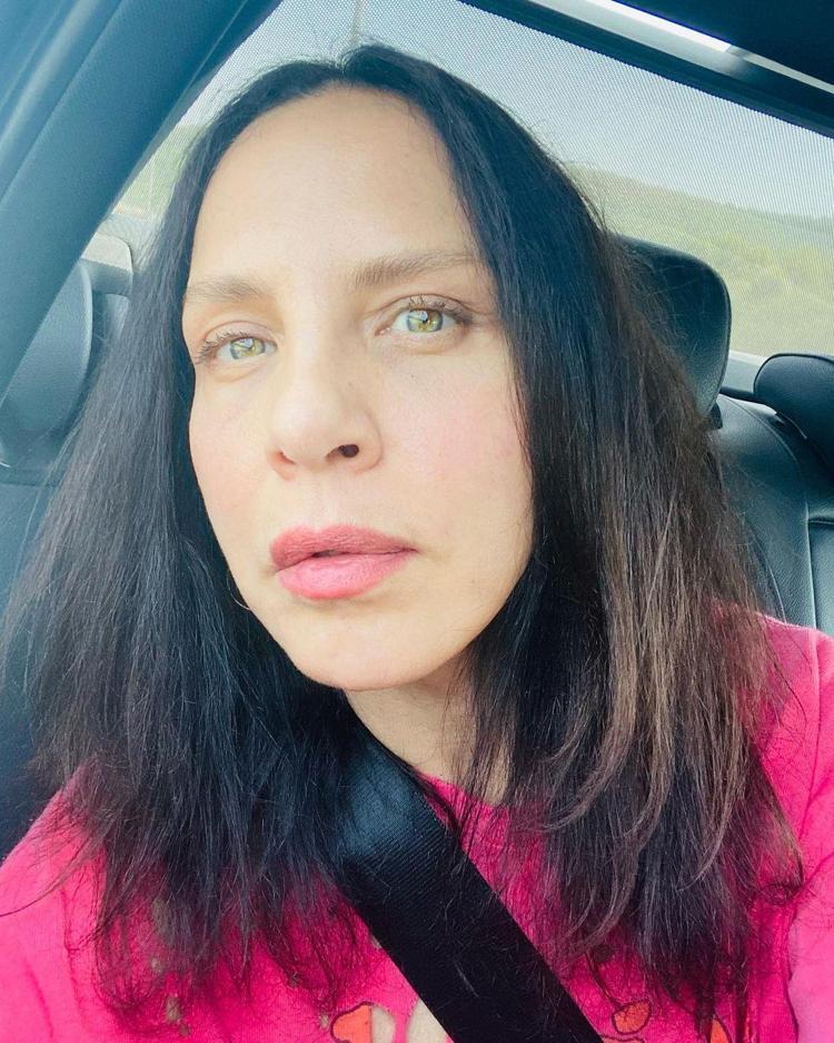 Sertab Erener'in estetikli görüntüsü olay oldu! 'Doktoruna dava açmalı ...