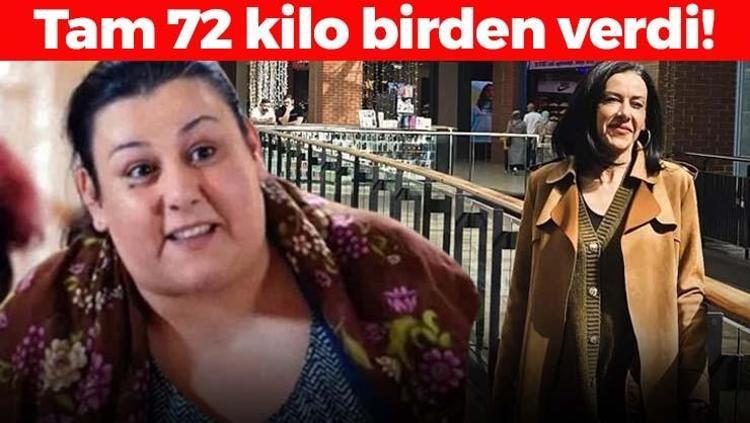 Tam 72 kilo verdi! Esin Gündoğdu 138 kilodan 66'ya düştü: Mum gibi ...