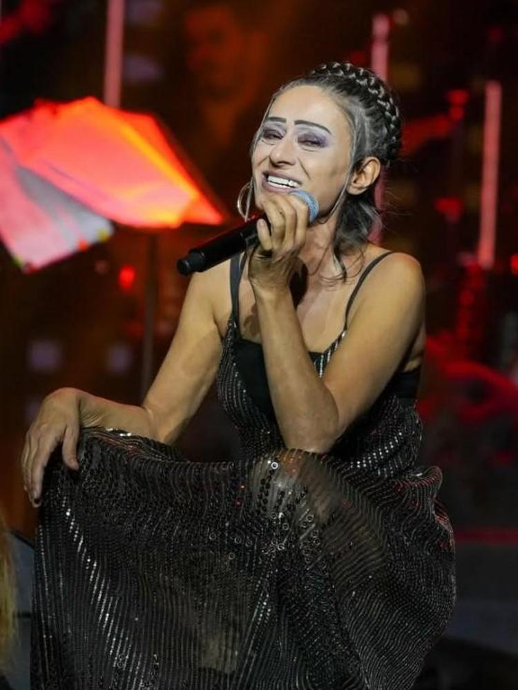 Yıldız Tilbe'nin yüzünde kimyasal yanıklar oluştu! Son hali korkuttu ...