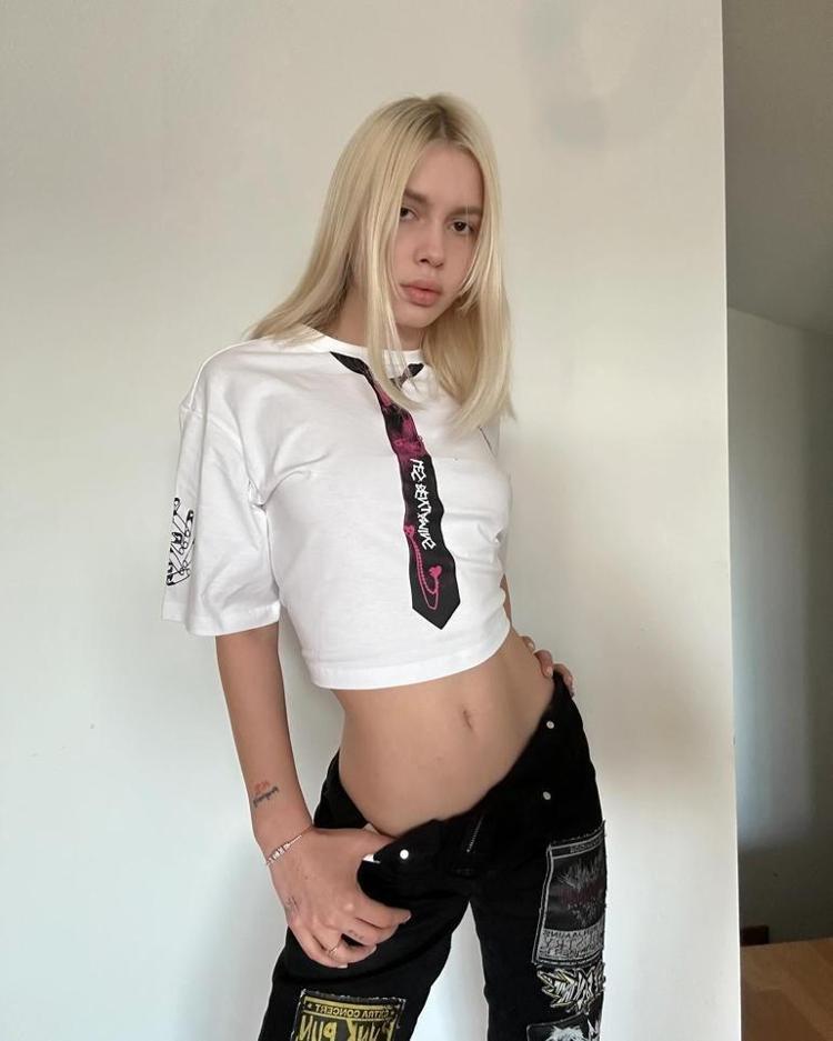 Aleyna Tilki'den sevenlerini korkutan paylaşım! - Magazin Haberleri - Sayfa 1