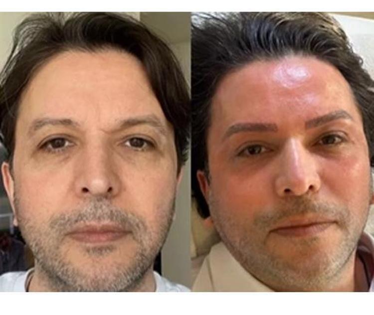 Nihat Doğan estetik yaptırdı! Son halini gören tanıyamadı - Son Dakika ...