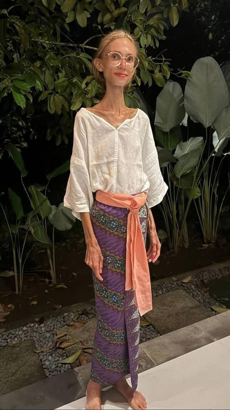 22 kiloya kadar düşen sosyal medya fenomeni Karolina Krzyzak hayatını kaybetti - Magazin ...